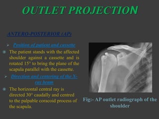 SHOULDER JOINT | PPTX