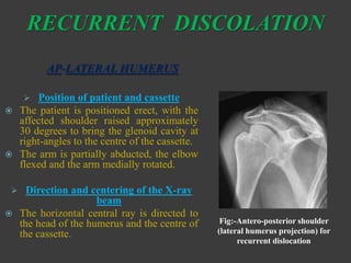 SHOULDER JOINT | PPTX