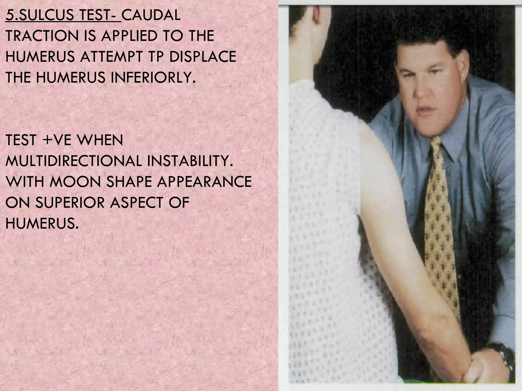 Shoulder instability | PPT