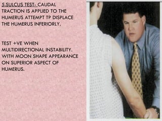 Shoulder instability | PPT