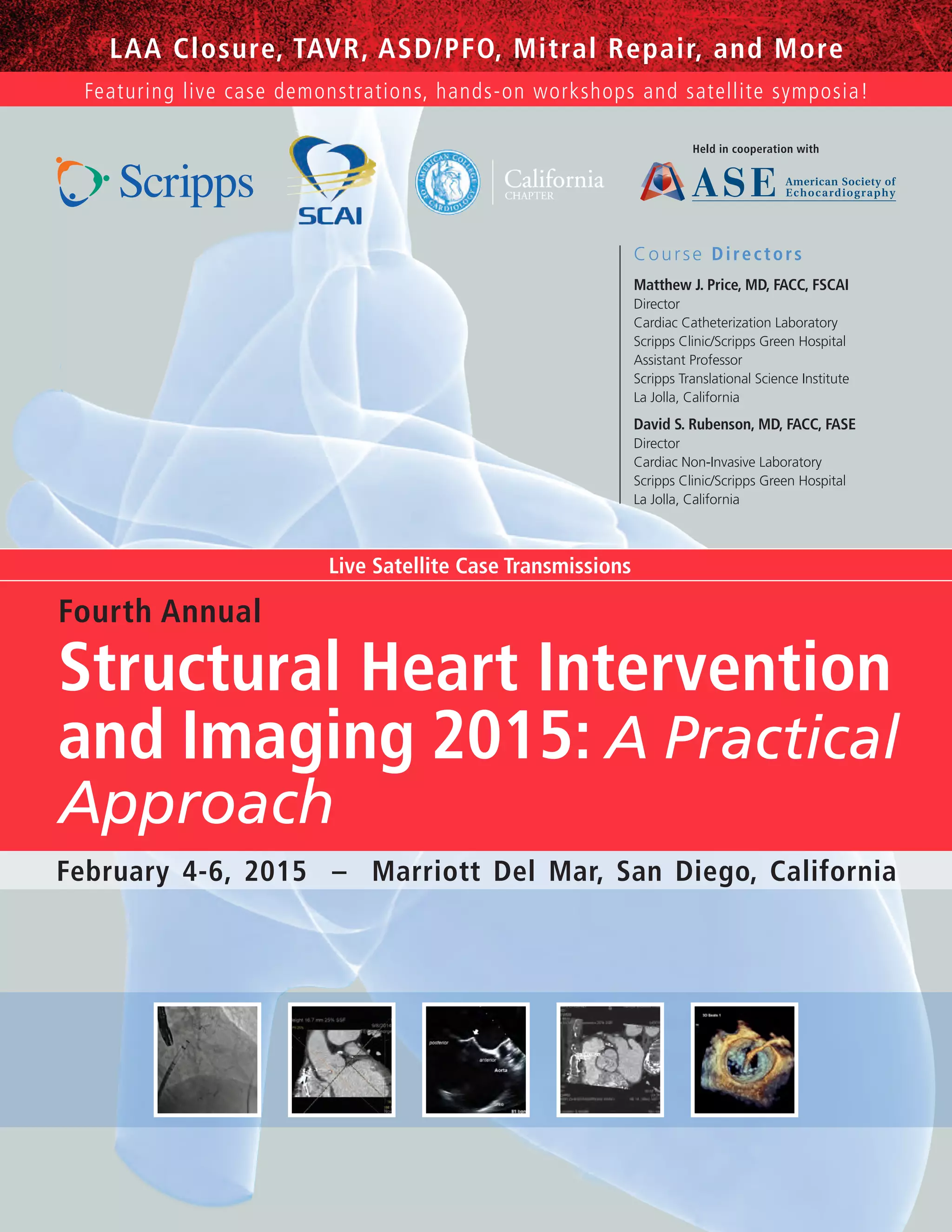 Structural Heart Intervention and Imaging Brochure 2015 | PDF