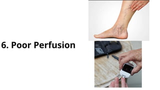 Factors affecting wound healing. A presentation on Surgical Management ...