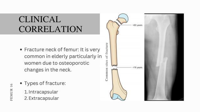 The Longest bone: FEMUR PPT. by SHABAB ANWAR | PPT