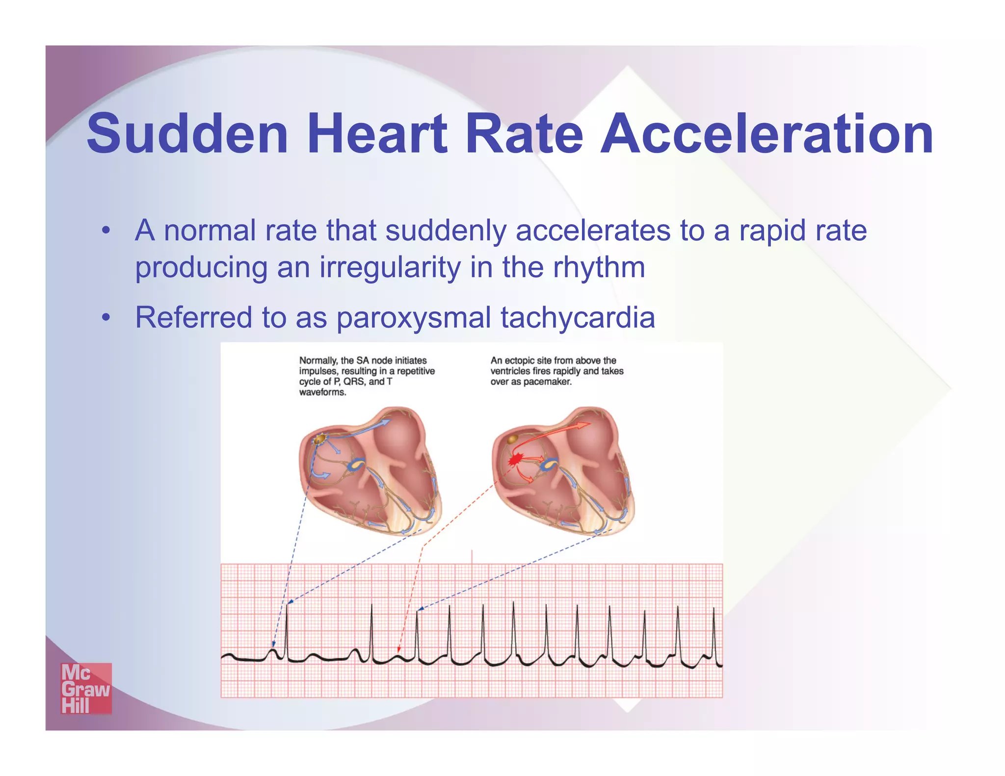 Shadechapter04.ppt [read only] | PDF