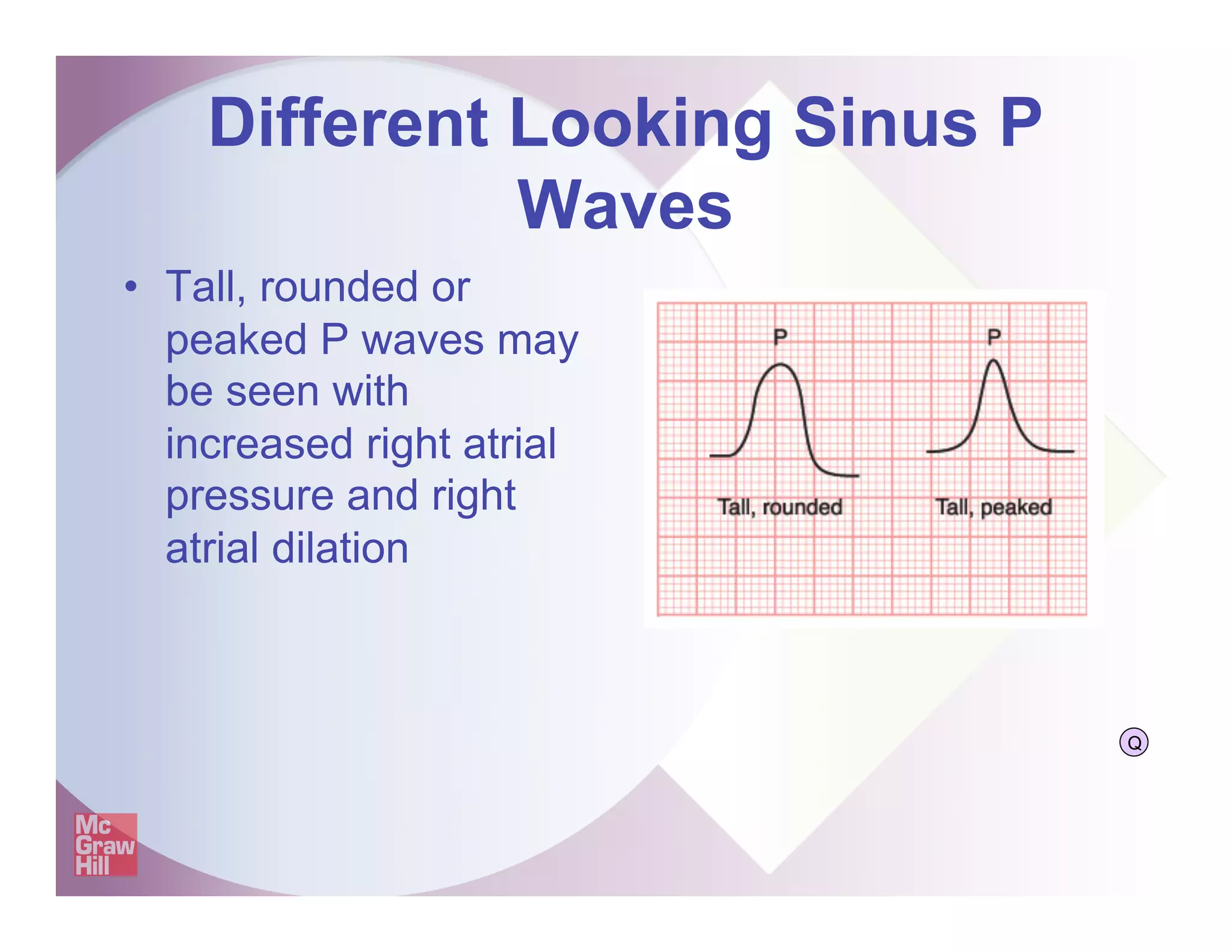 Shadechapter05.ppt [read only] | PDF