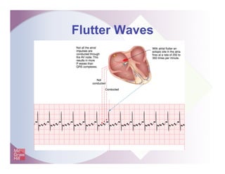 Shadechapter05.ppt [read only] | PPT