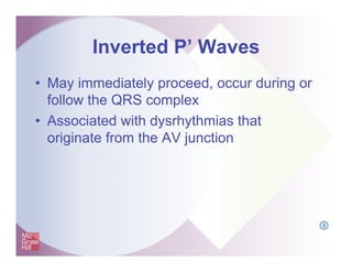 Shadechapter05.ppt [read only] | PPT