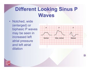 Shadechapter05.ppt [read only] | PPT