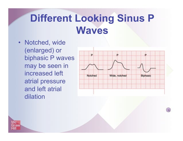 Shadechapter05.ppt [read only] | PPT