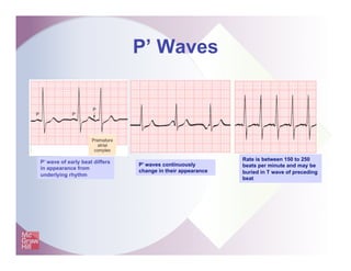 Shadechapter05.ppt [read only] | PPT