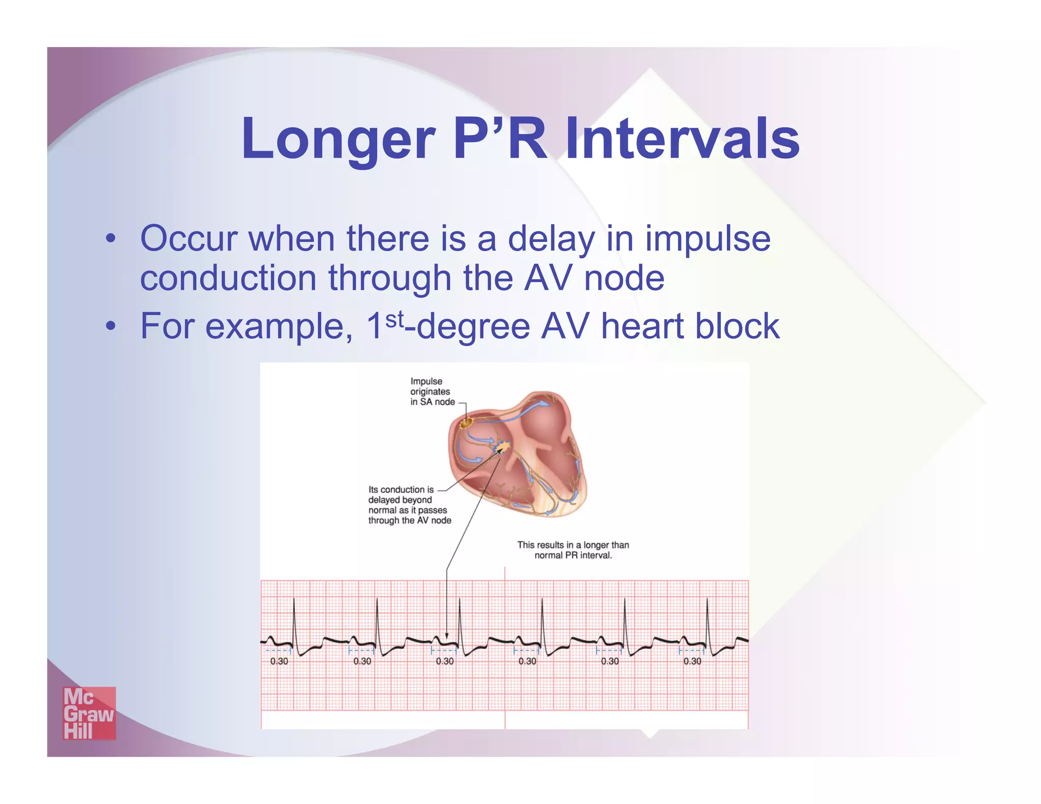 Shadechapter07.ppt [read only] | PDF