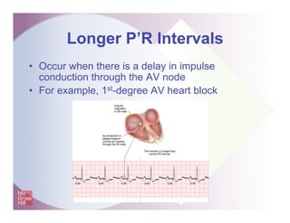 Shadechapter07.ppt [read only] | PPT