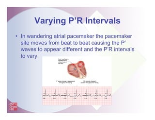 Shadechapter07.ppt [read only] | PPT