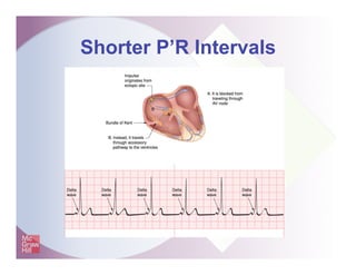 Shadechapter07.ppt [read only] | PPT