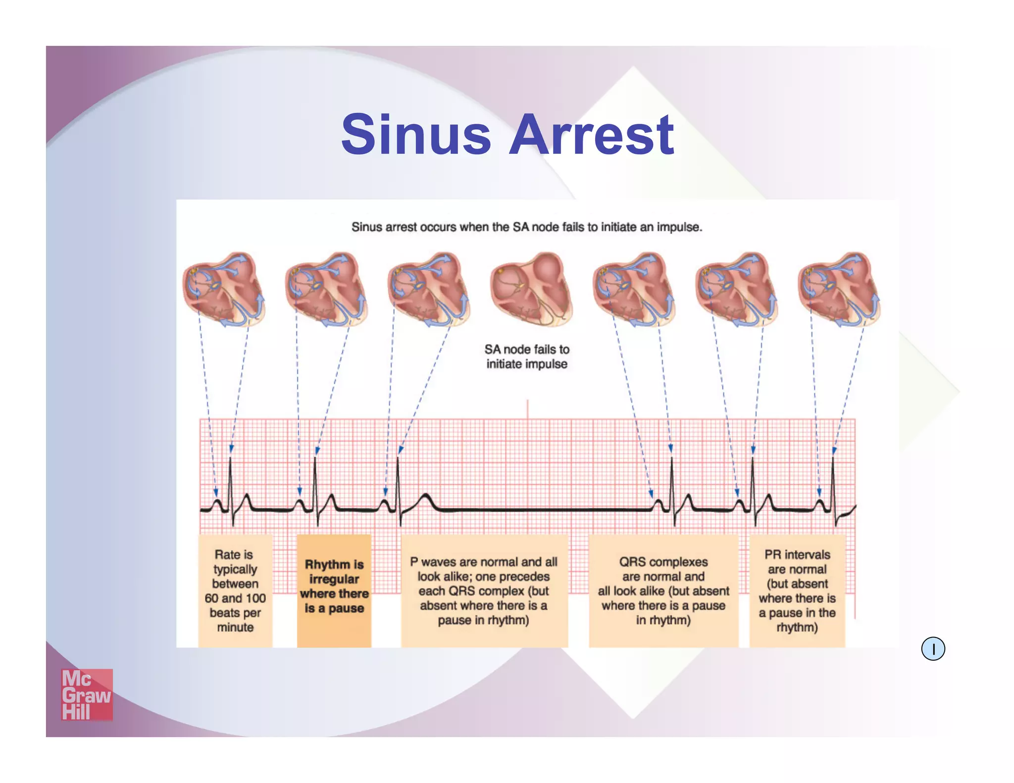 Shadechapter08.ppt [read only] | PDF