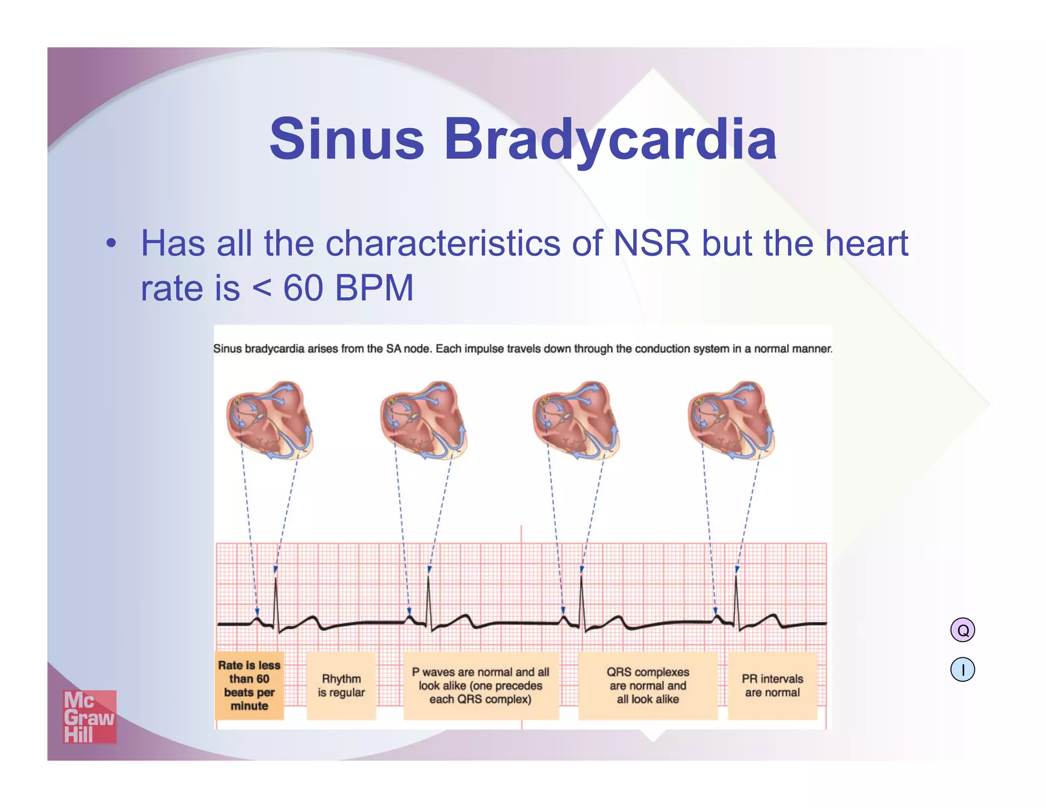 Shadechapter08.ppt [read only] | PDF