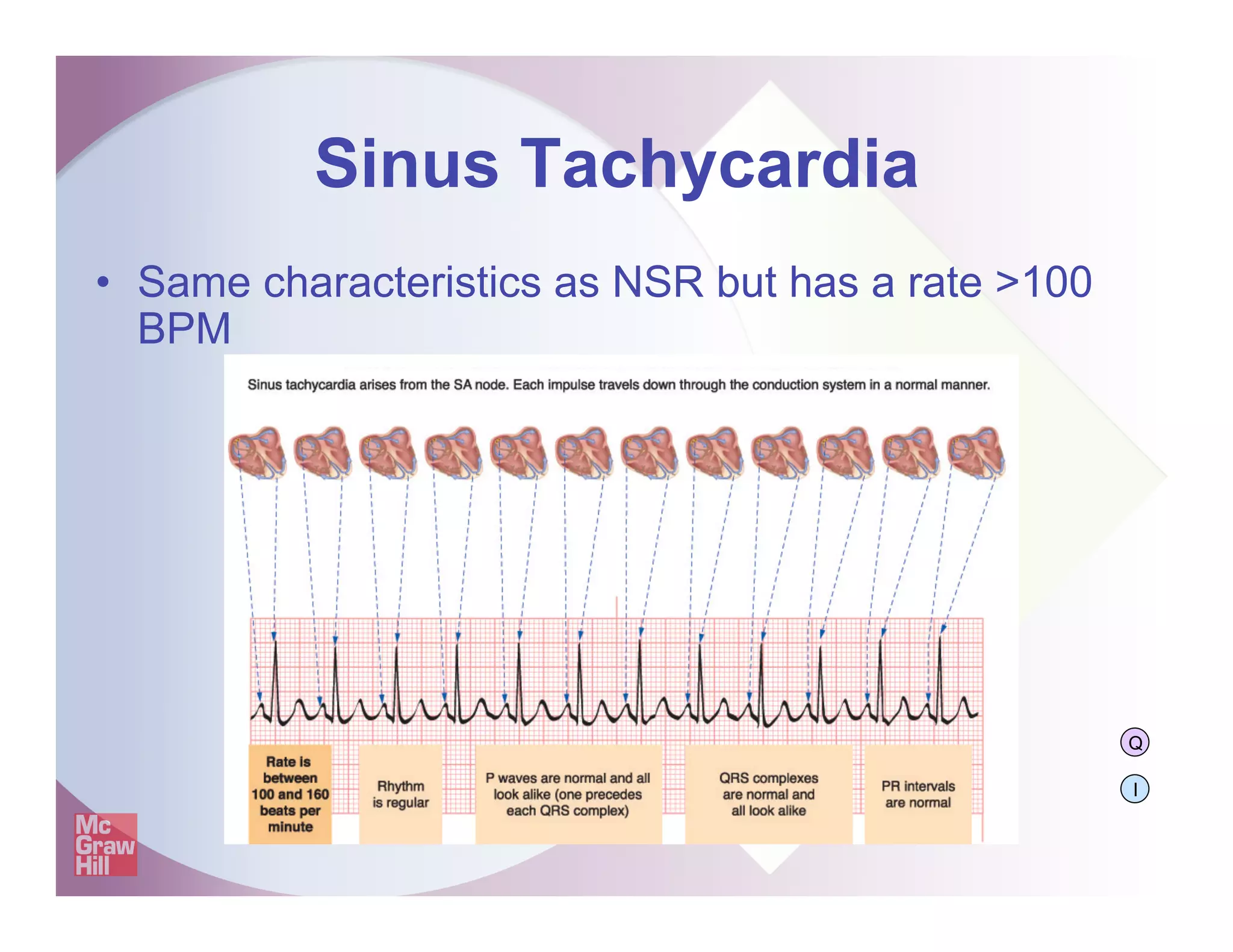 Shadechapter08.ppt [read only] | PDF