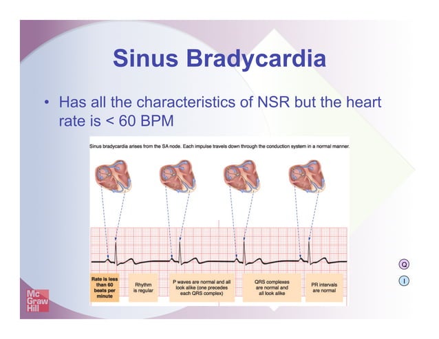 Shadechapter08.ppt [read only] | PPT | Free Download