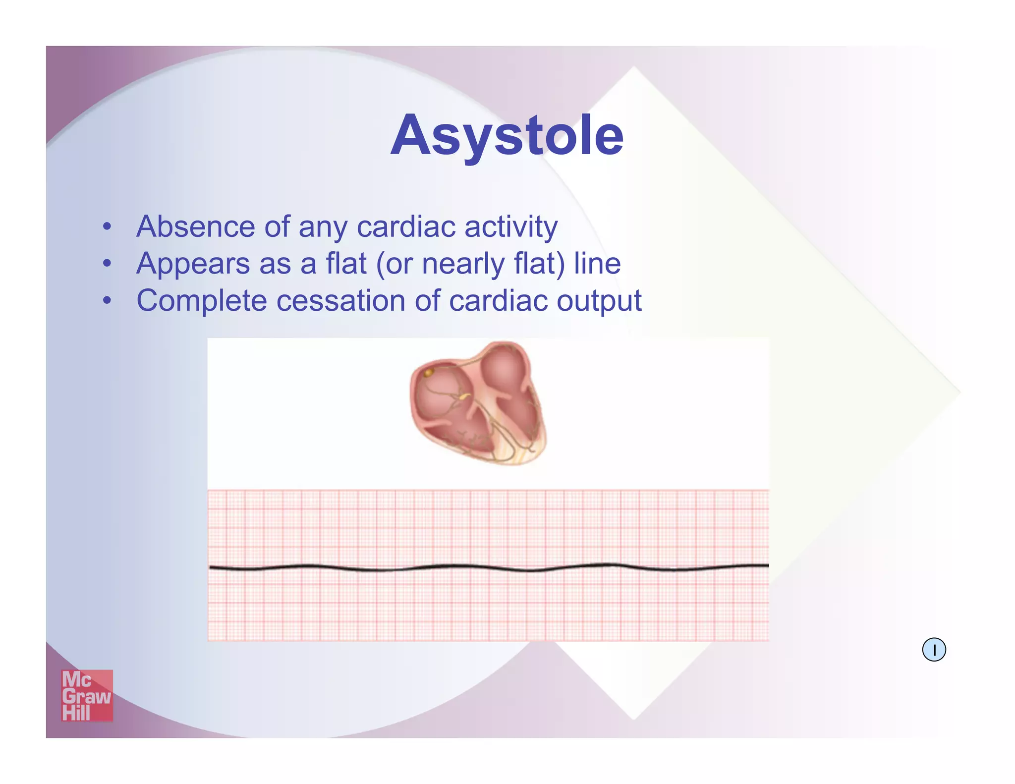 Shadechapter11.ppt [read only] | PDF