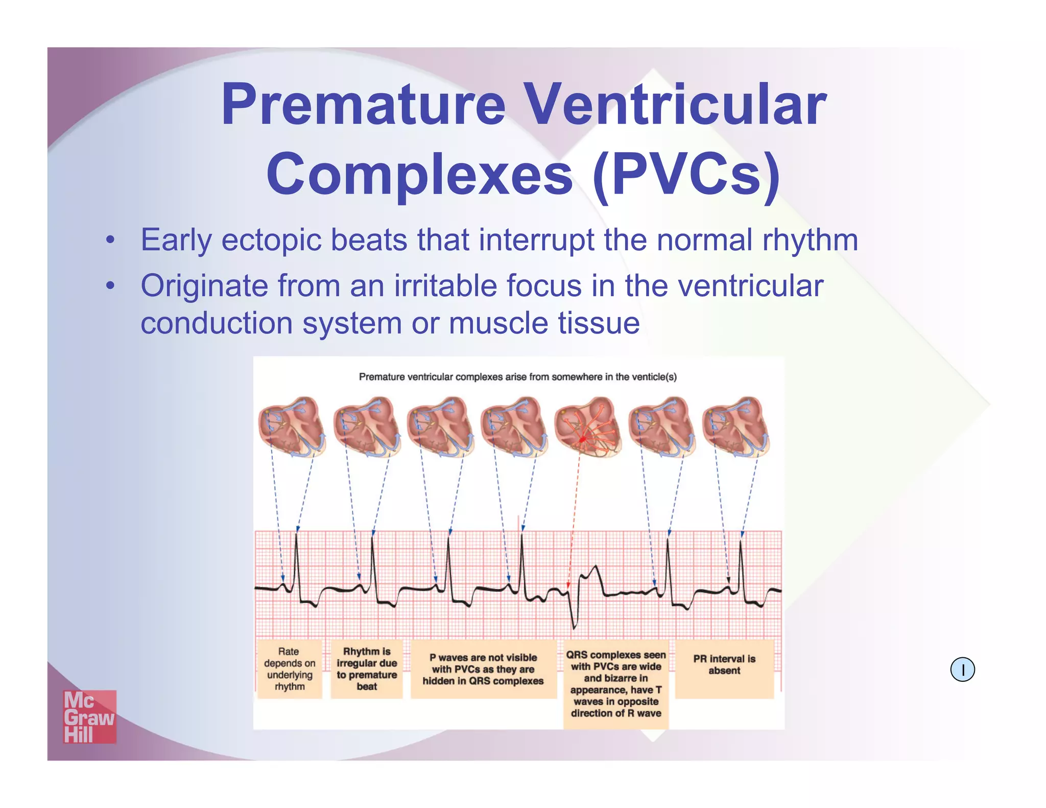 Shadechapter11.ppt [read only] | PDF