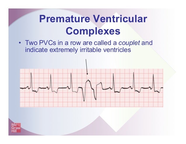 Shadechapter11.ppt [read only]