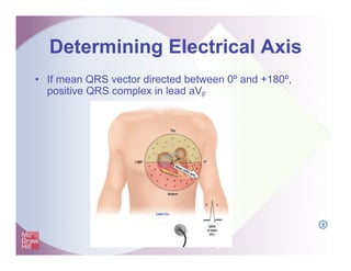 Shadechapter13.ppt [read only] | PDF