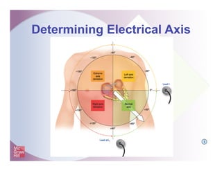 Shadechapter13.ppt [read only] | PDF