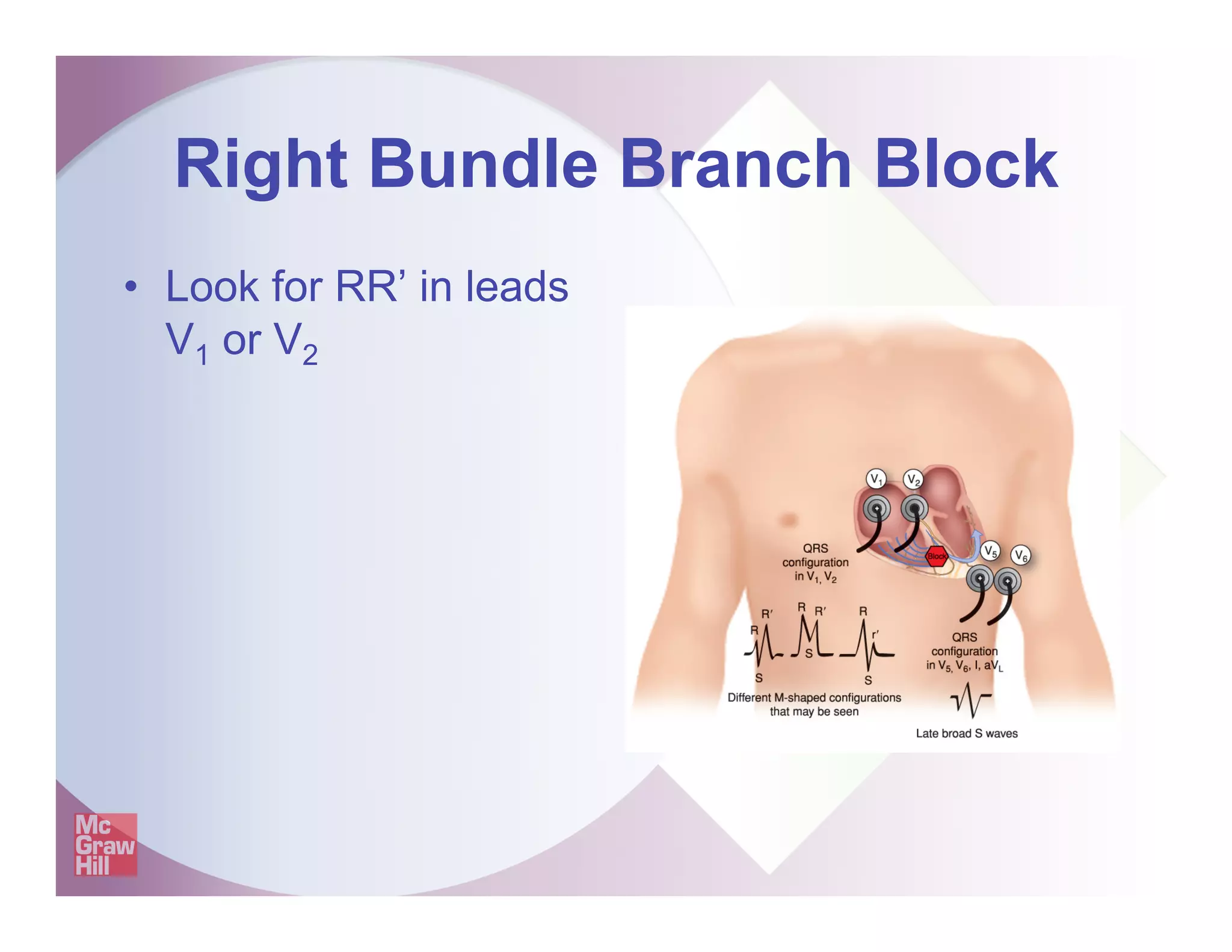 Shadechapter14.ppt [read only] | PDF