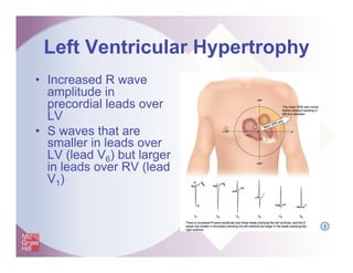 Shadechapter14.ppt [read only] | PDF