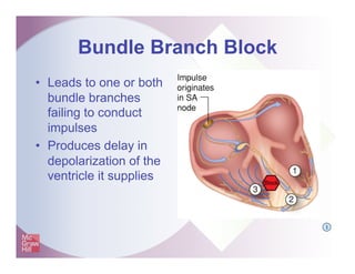 Shadechapter14.ppt [read only] | PDF