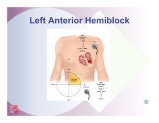 Shadechapter14.ppt [read only] | PDF