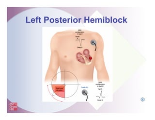 Shadechapter14.ppt [read only] | PDF