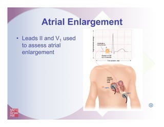 Shadechapter14.ppt [read only] | PDF