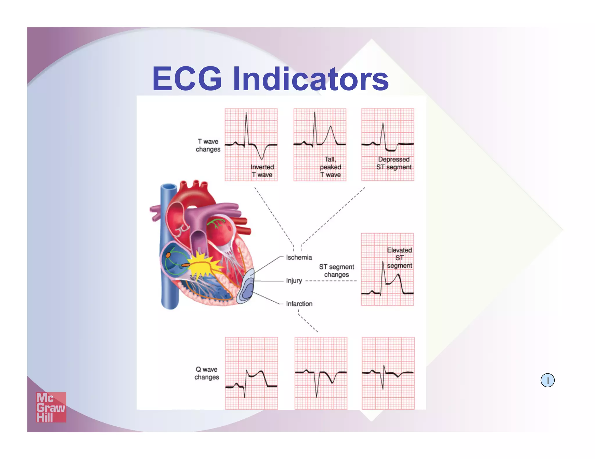 Shadechapter15.ppt [read only] | PDF