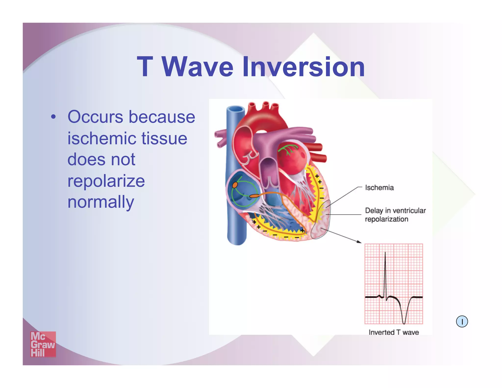 Shadechapter15.ppt [read only] | PDF