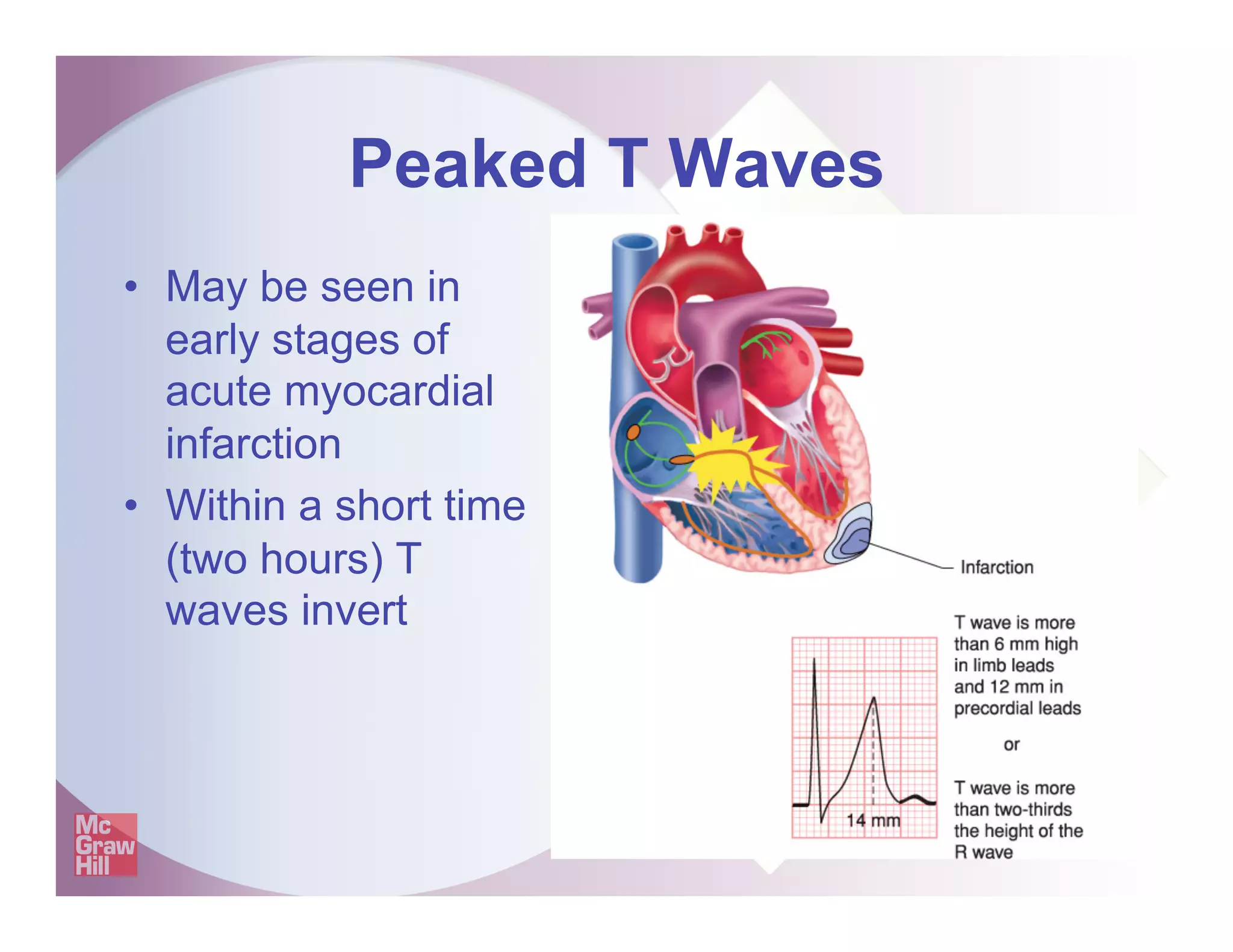 Shadechapter15.ppt [read only] | PDF