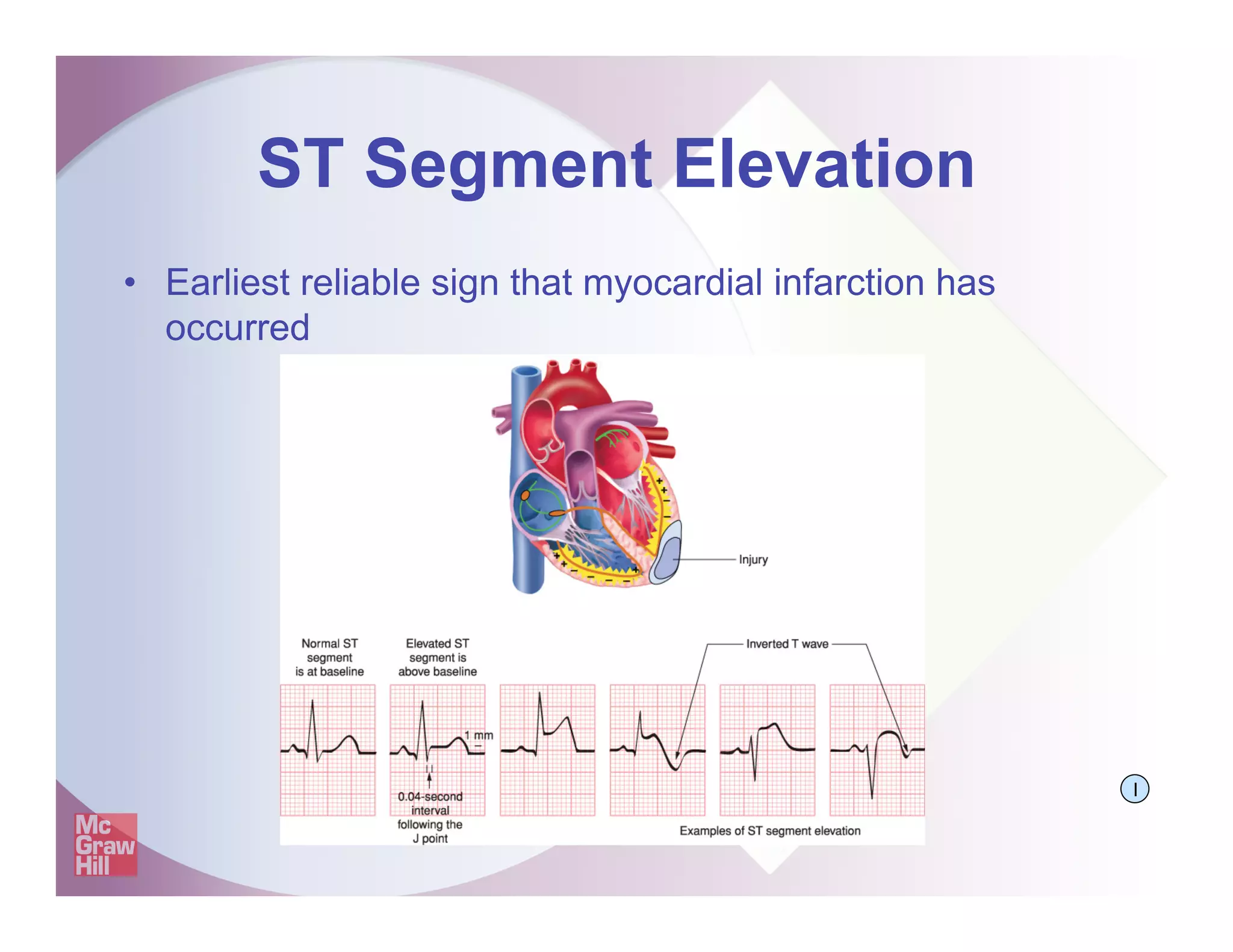 Shadechapter15.ppt [read only] | PDF