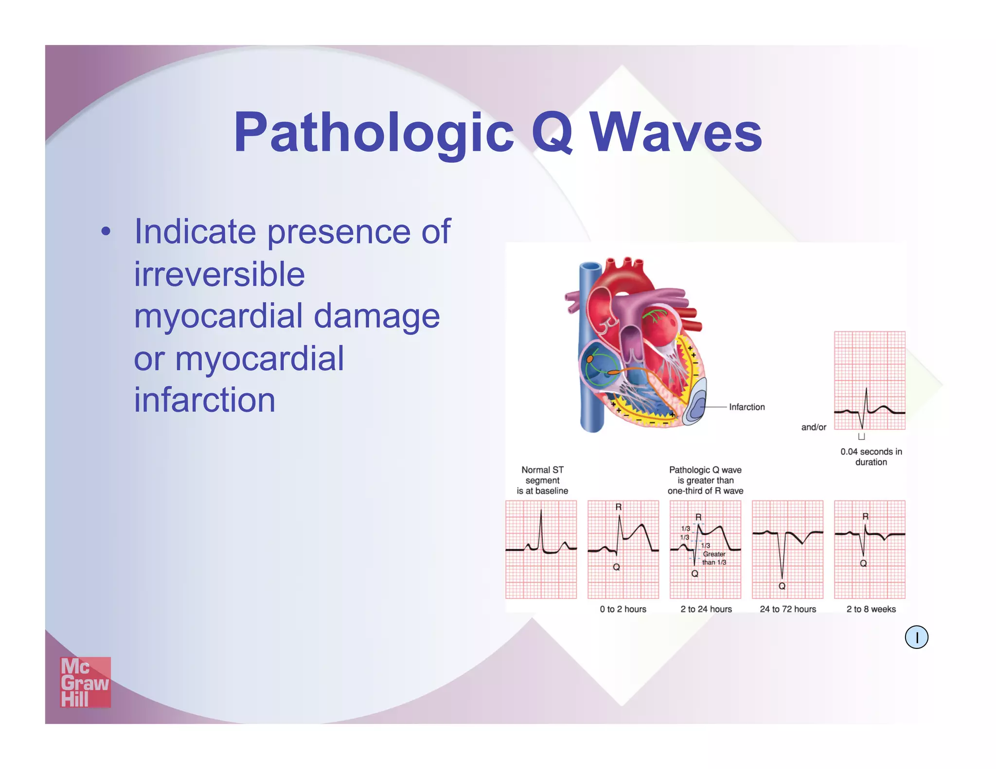 Shadechapter15.ppt [read only] | PDF