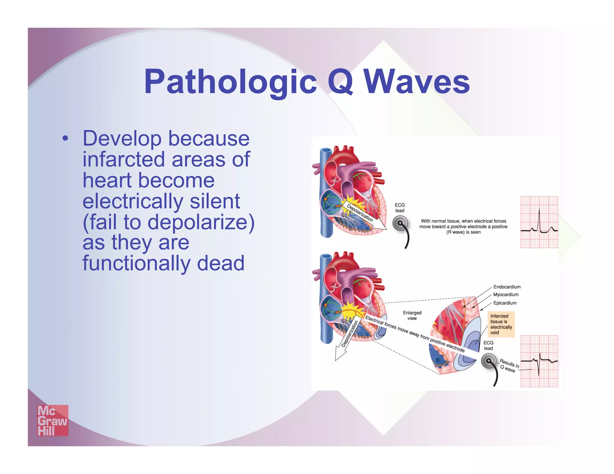 Shadechapter15.ppt [read only] | PDF