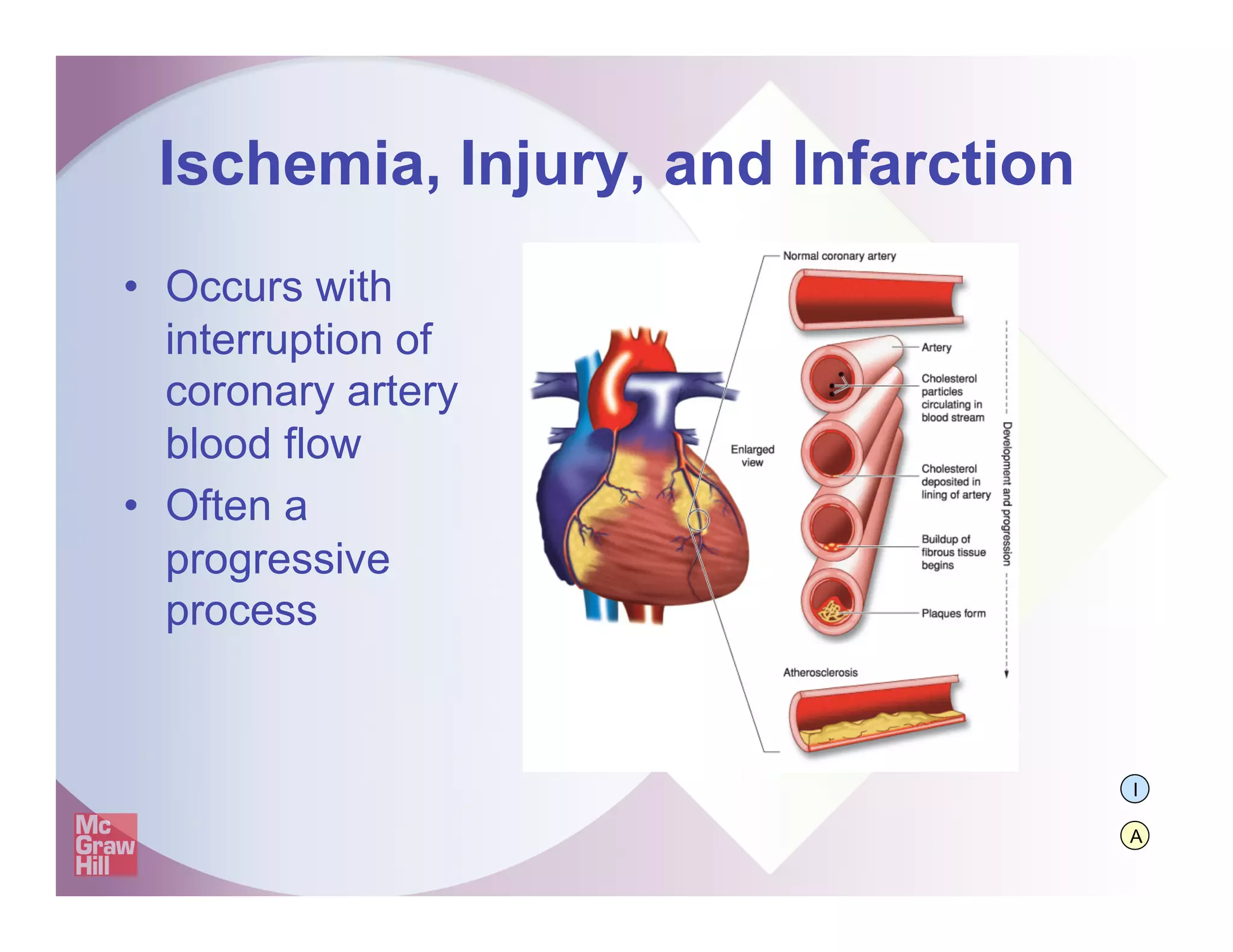 Shadechapter15.ppt [read only] | PDF