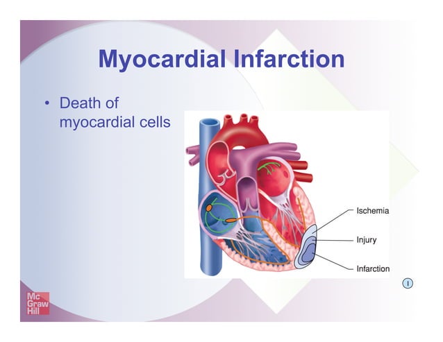 Shadechapter15.ppt [read only] | PDF