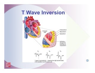 Shadechapter15.ppt [read only] | PDF