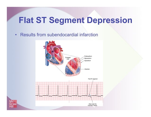 Shadechapter15.ppt [read only] | PDF
