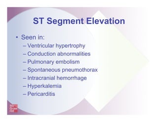 Shadechapter15.ppt [read only] | PDF