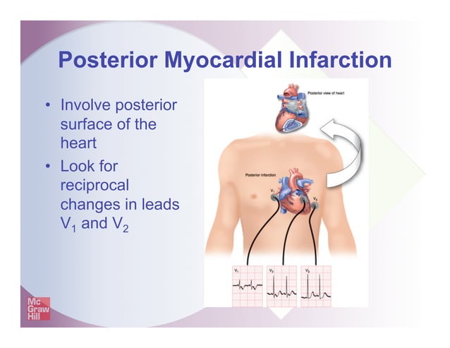 Shadechapter15.ppt [read only] | PDF