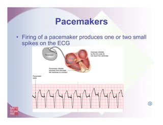 Shadechapter16.ppt [read only] | PPT