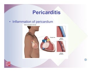 Shadechapter16.ppt [read only] | PPT