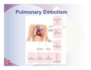 Shadechapter16.ppt [read only] | PPT