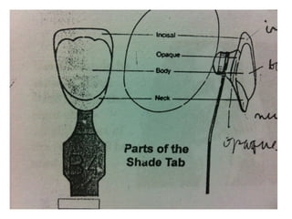 Shade selection | PPT
