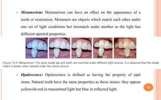 Shade selection | PPTX